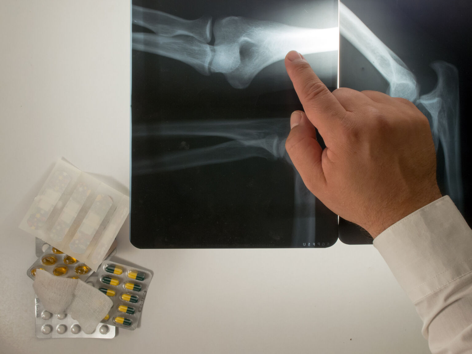 Doctor and-x ray | Copyright-free photo (by M. Vorel) | LibreShot